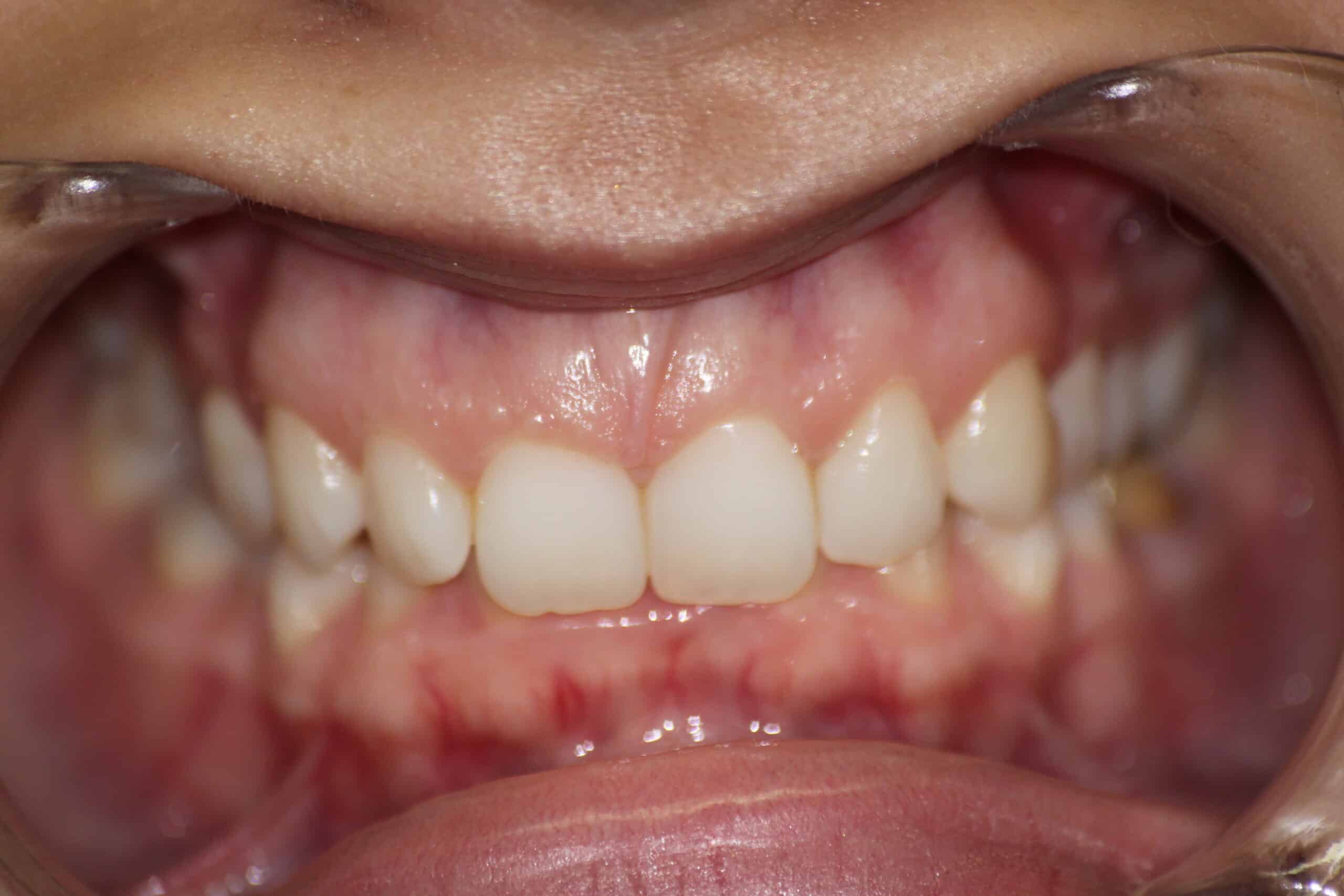 Cazuri Clinice - Clinica Stomatologie si Ortodontie Cluj